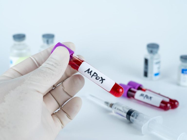 Africa Lifts Health Emergency over Mpox - Africa Press English