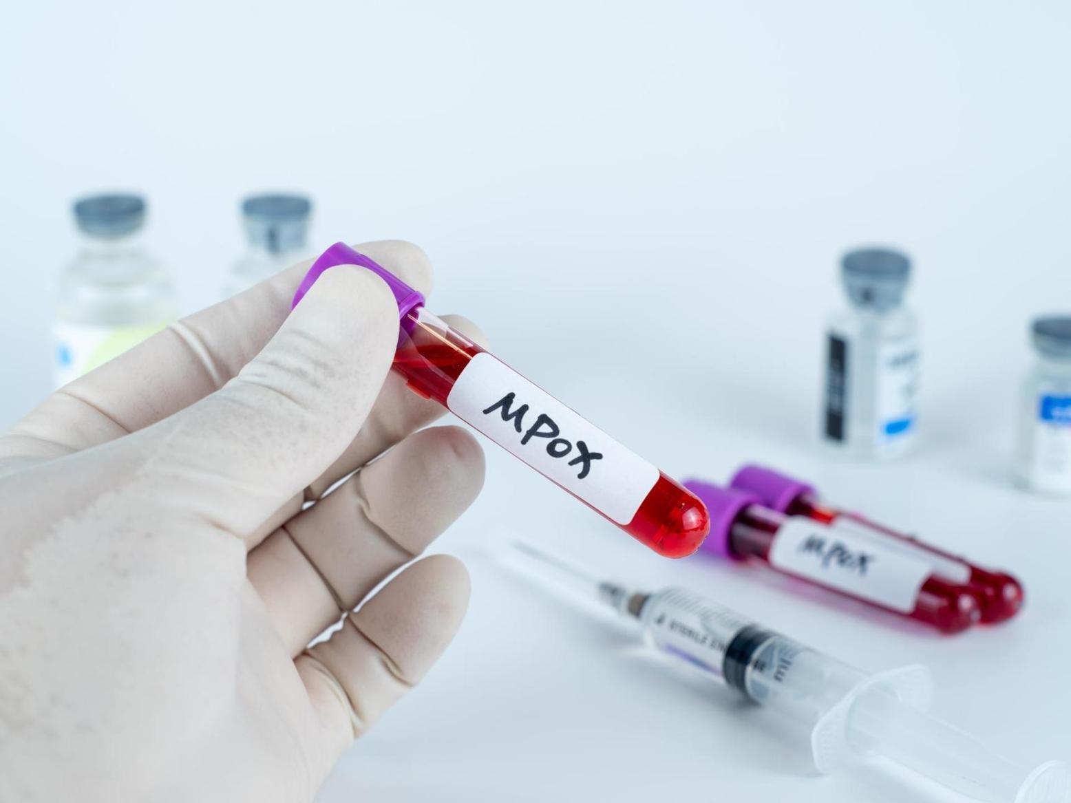 Africa Lifts Health Emergency over Mpox - Africa Press English