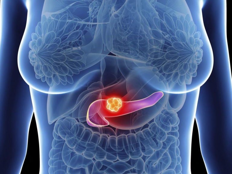Cancer Du Pancréas Éliminé Chez La Souris - Cameroun