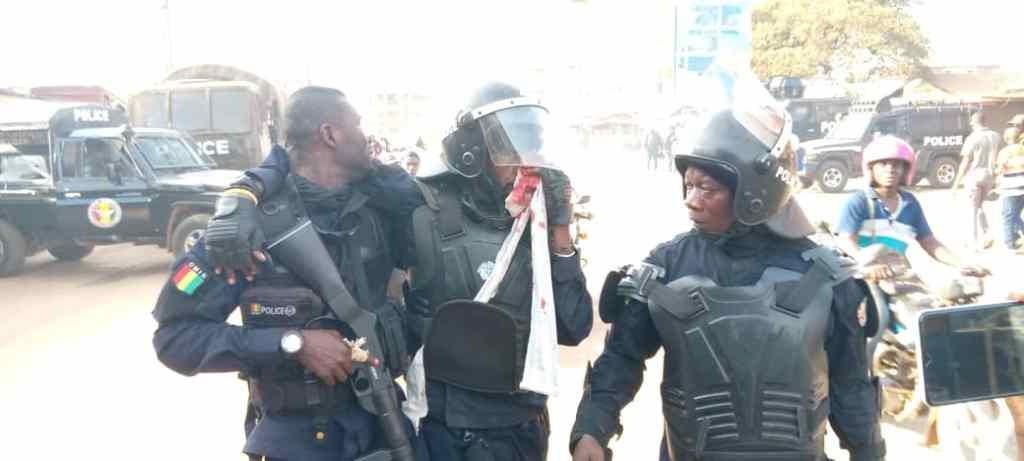 Manif à Cosa : Le bilan des blessés s’alourdit - guinee Conakry