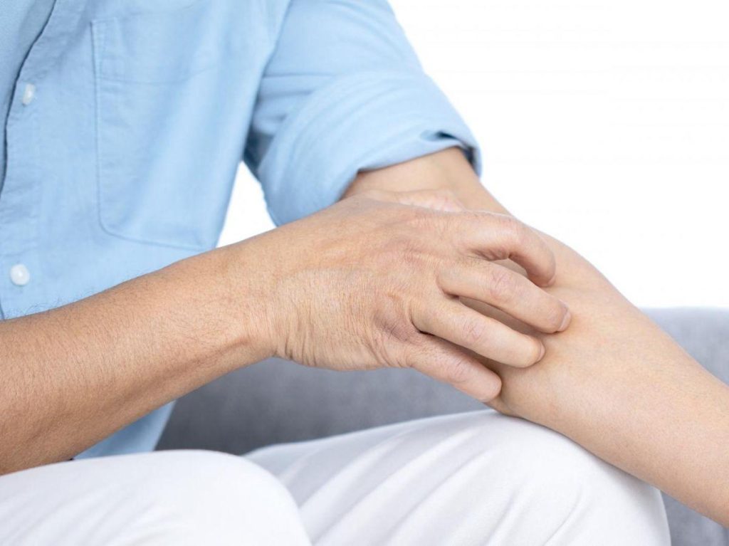 Eczéma et Force D’Adhésion du Staphylocoque Doré - guinee Conakry