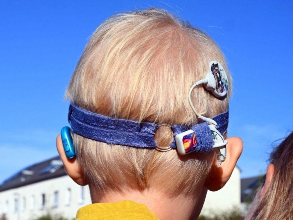 Surdité: L'Implant Cochléaire, une Solution "Miracle"? - Congo-kinshasa