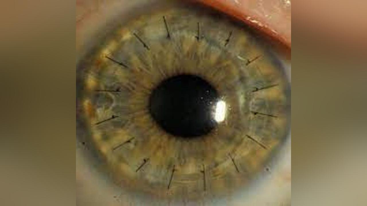 Culture, religion and the eye bank: Building on Ghana’s successful ...