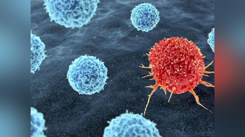 Une Double Immunothérapie Peut Vaincre Le Mélanome Le Plus Grave Des