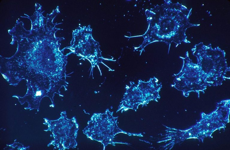 Scientists Сome Up With New Effective Method to Detect Cancer Cells in ...