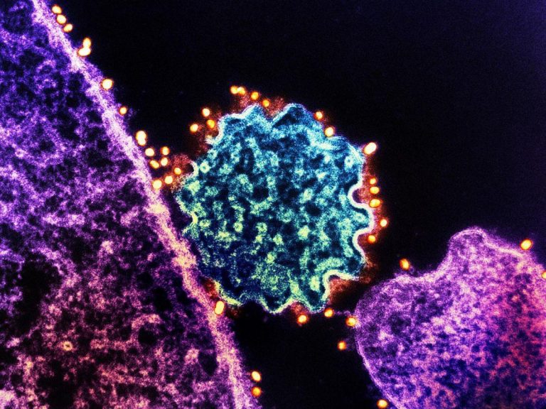 Nipah: quel Est ce Virus qui InquièTe L’Inde? - Senegal