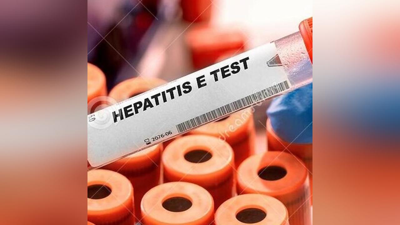 Hepatitis E outbreak in Wau - South Sudan