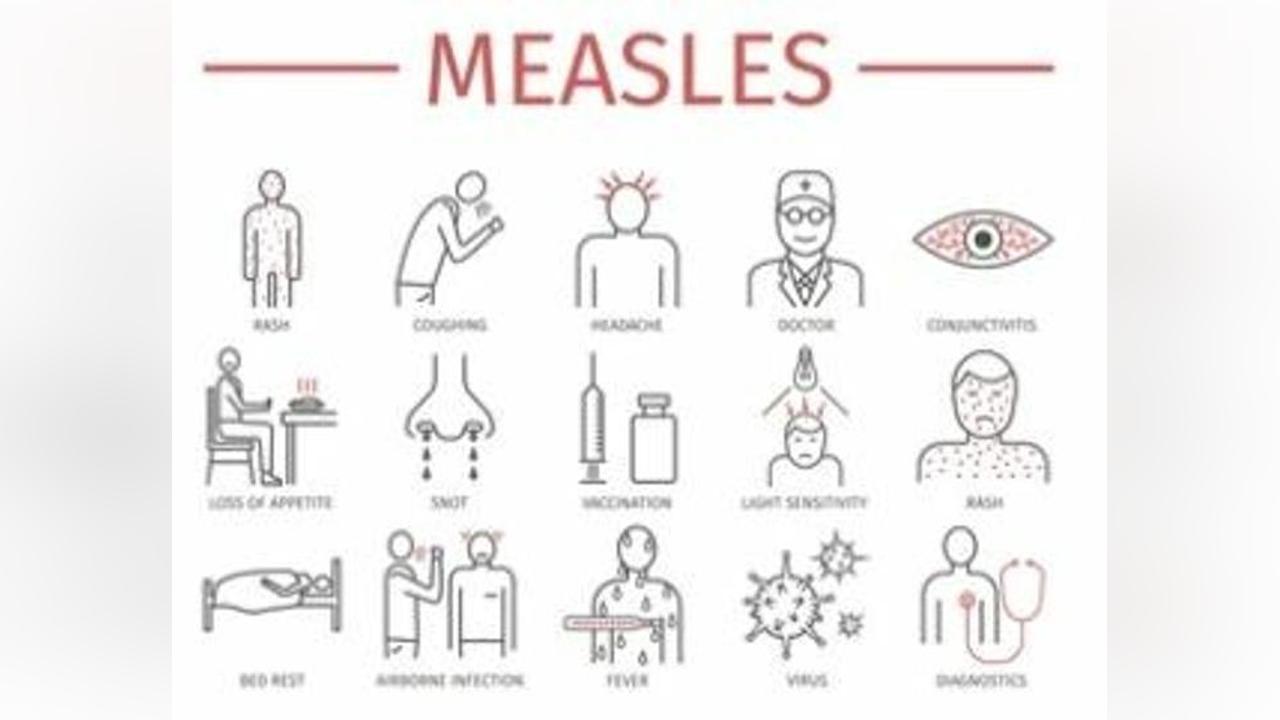 Suspected measles cases reported in Jonglei’s Ayod County - South Sudan