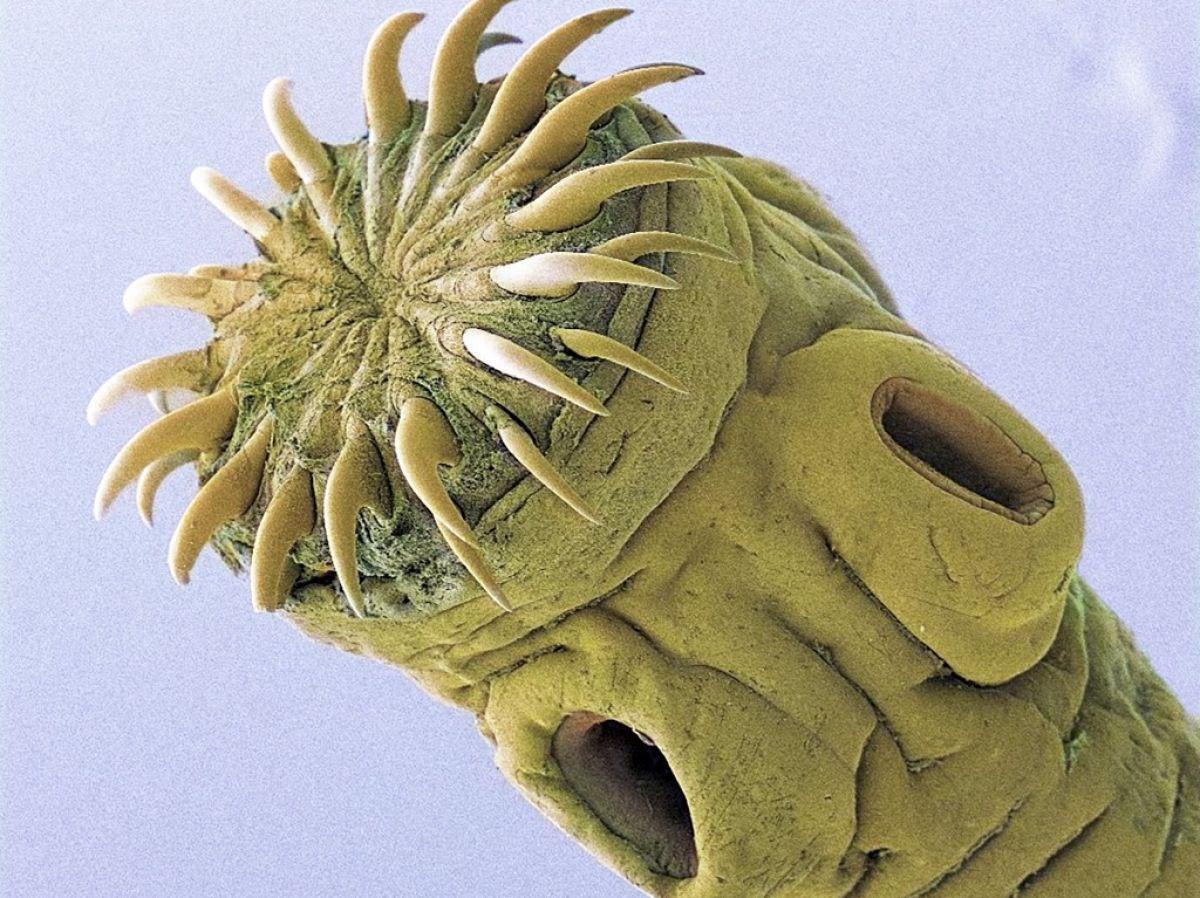 Ver solitaire, téniasis et cysticercoses : tout savoir sur des maladies ...