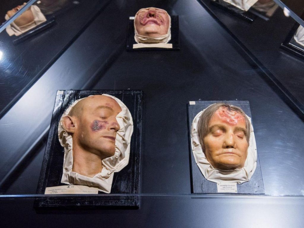 Syphilis Présente Chez Les Chasseurs-Cueilleurs Il Y A 5500 Ans - Togo