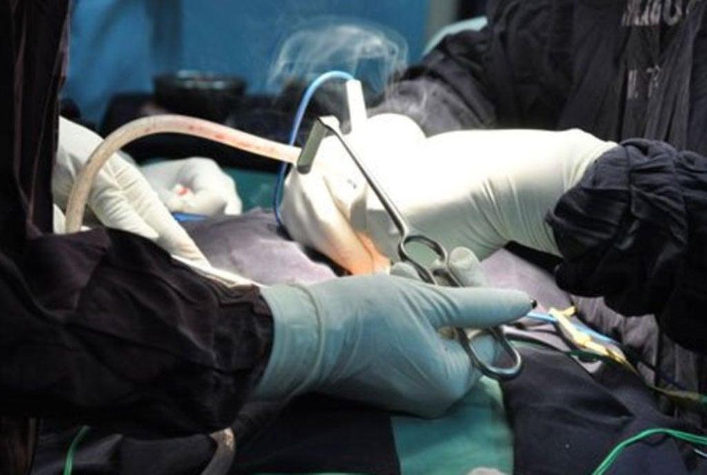 New treatment could help fix heart’s ‘forgotten valve’ - Uganda