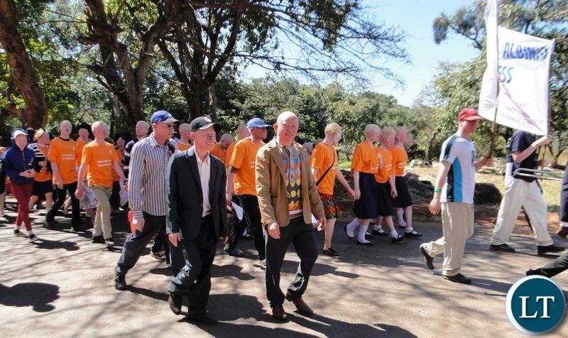 Albinism Foundation of Zambia urges Government to work with Albinism ...