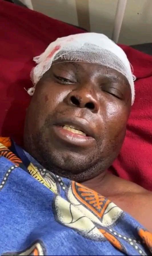 TWO PF SUPPORTERS INJURED IN AFTER ALLEGEDLY BEING AT ATTACKED BY ...